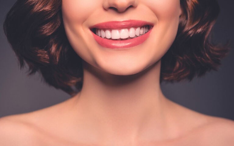 The Art of Natural-Looking Veneers | Best Self Atlanta